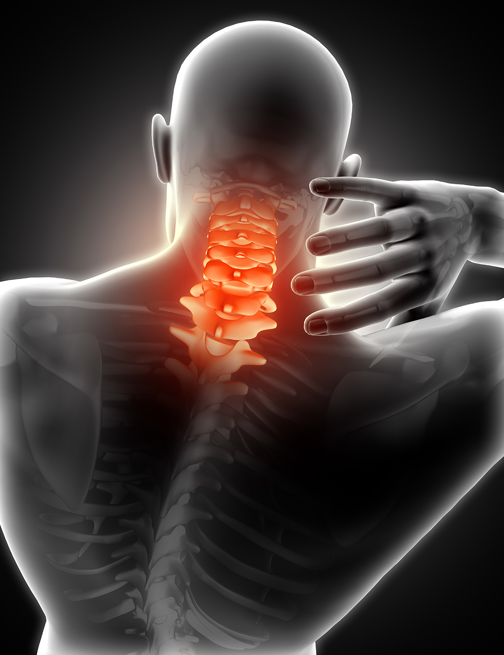 Neck Pain - Dr. Abhijit Pawar